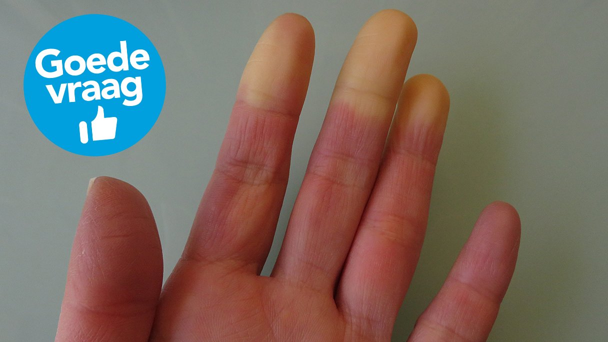 Last van witte gevoelloze vingers of tenen als het koud is ...