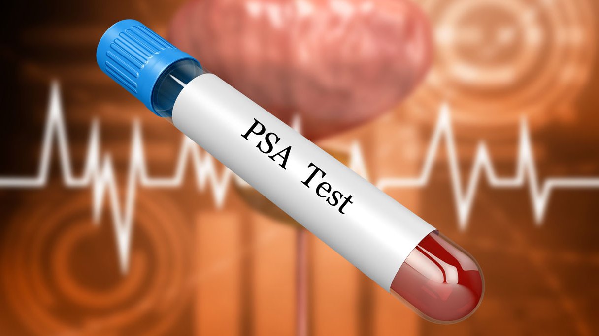 Wat is een normale PSA-waarde? | Gezondheidsnet