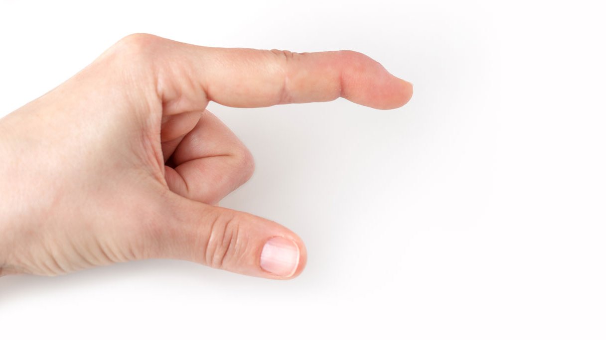 Het topje van mijn vinger blijft in de buigstand, wat nu? | Gezondheidsnet