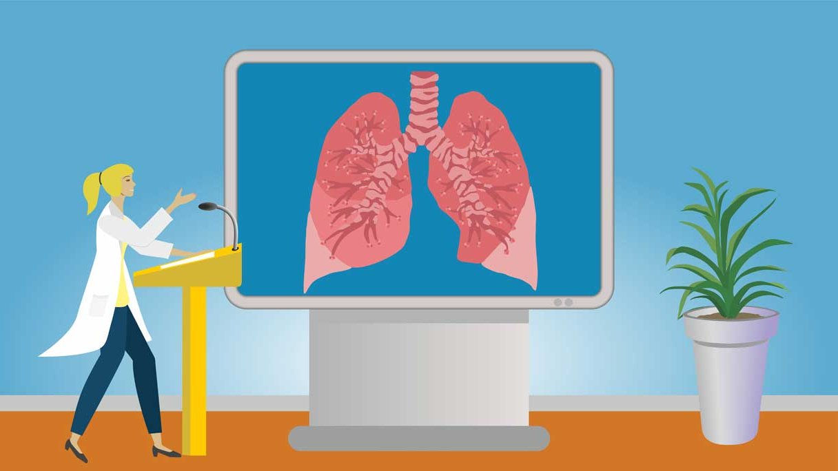 Dotterbehandeling bij chronische longembolie kan grote impact hebben ...