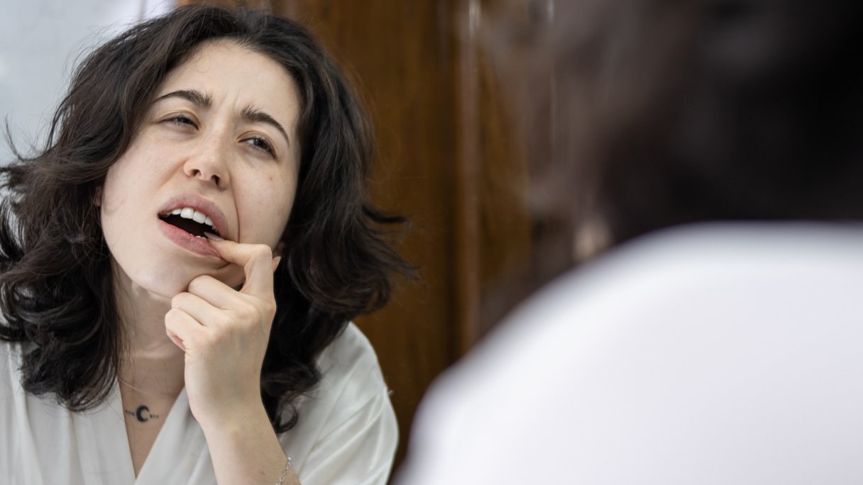 Waar komt die uitslag rond mijn mond vandaan? | Gezondheidsnet