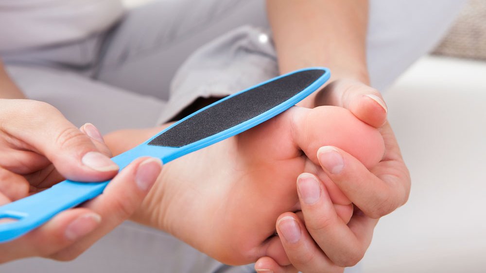 Verwijder je eeltplekken | Gezondheidsnet