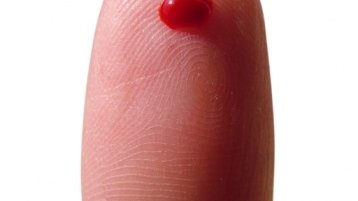 'Bij bloedingen eerder controleren op Von Willebrand' | Gezondheidsnet