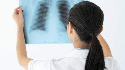 Longembolie door spataderen? | Gezondheidsnet