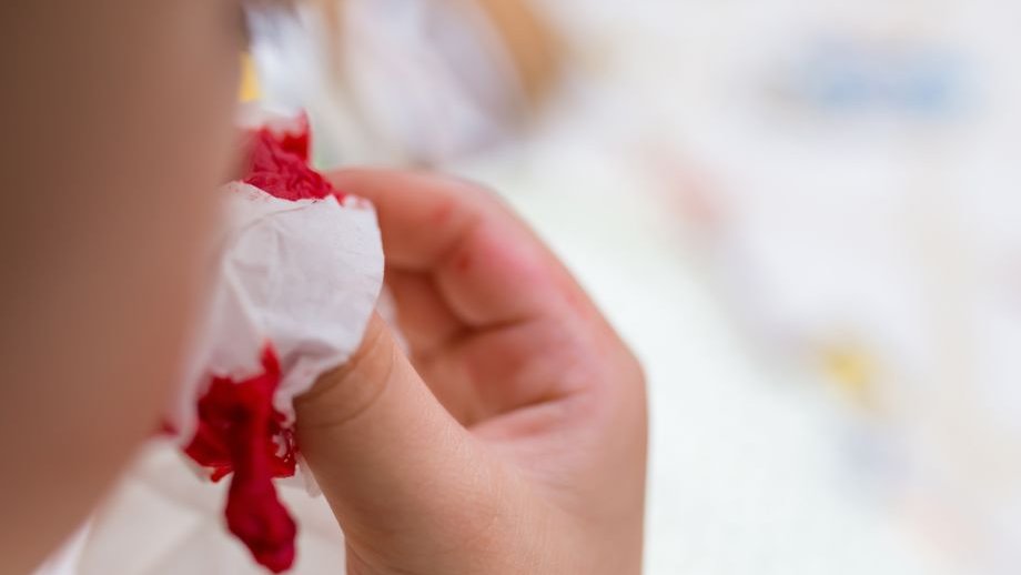 Bloedneus: wat is het en hoe komt het? | Gezondheidsnet
