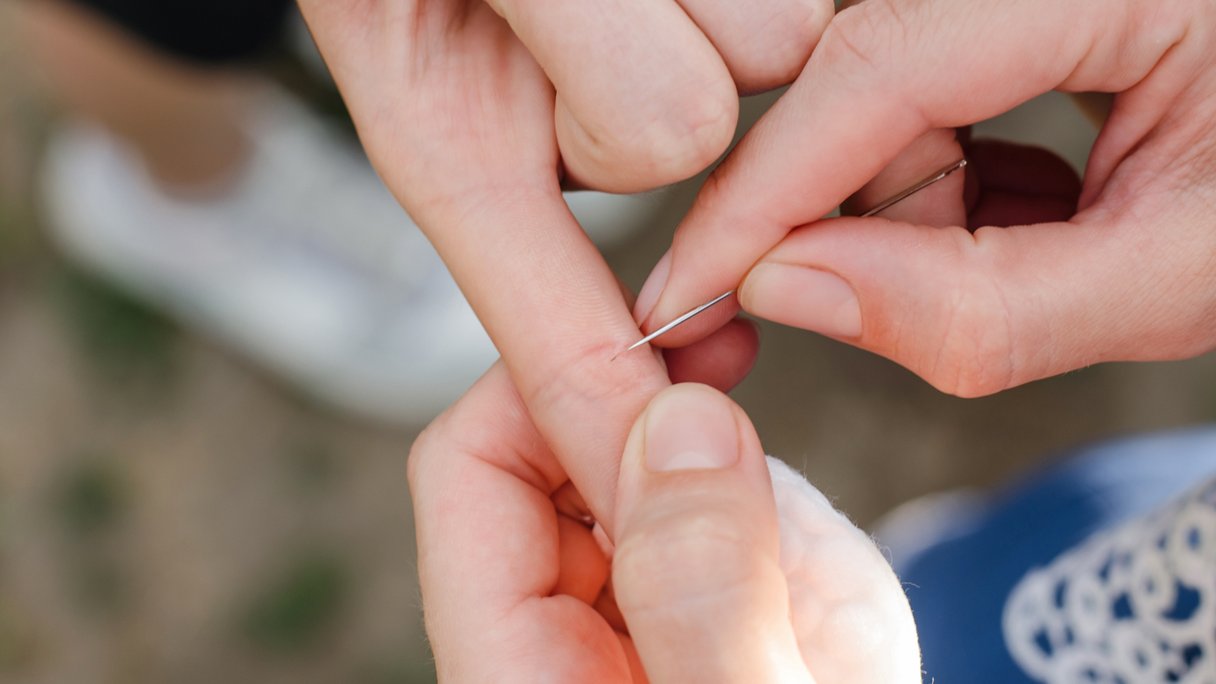 Hoe verwijder je een splinter? | Gezondheidsnet