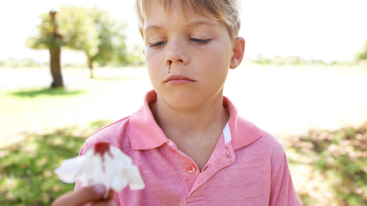 Mijn kind heeft een bloedneus | Gezondheidsnet