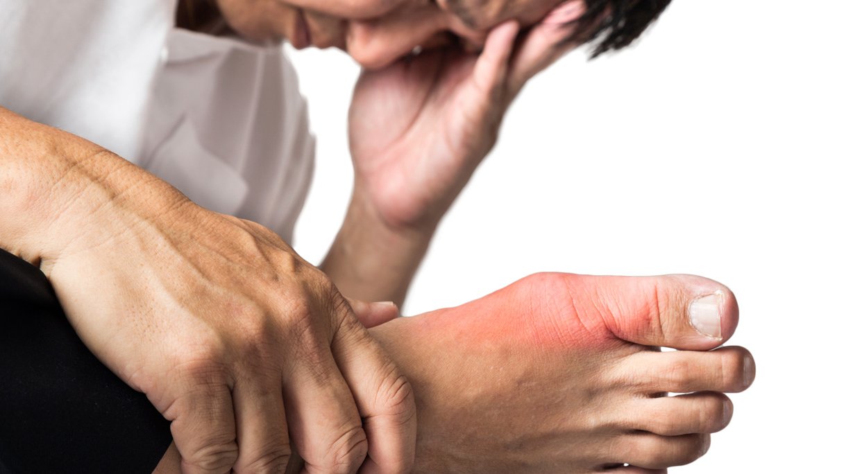 Helpt een purinebeperkt dieet bij jicht? | Gezondheidsnet