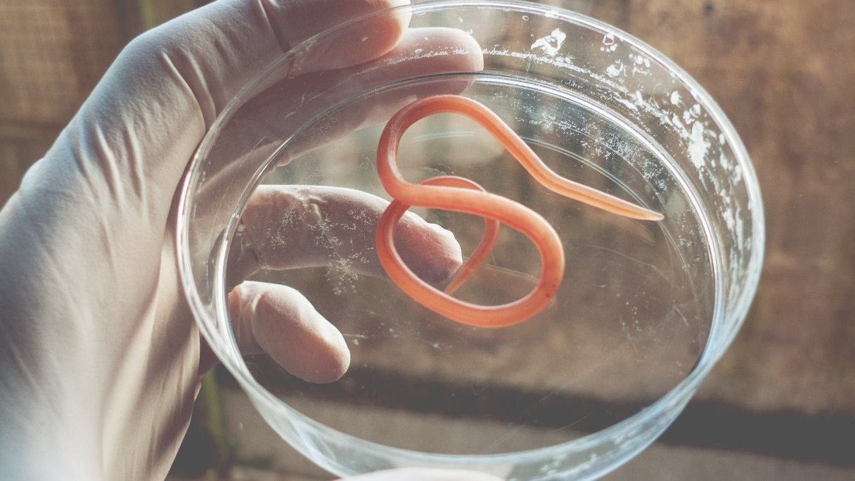 Help, ik heb wormen! | Gezondheidsnet